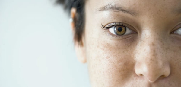 Manchas oscuras en la piel: conoce las causas y prevención | Hedonai