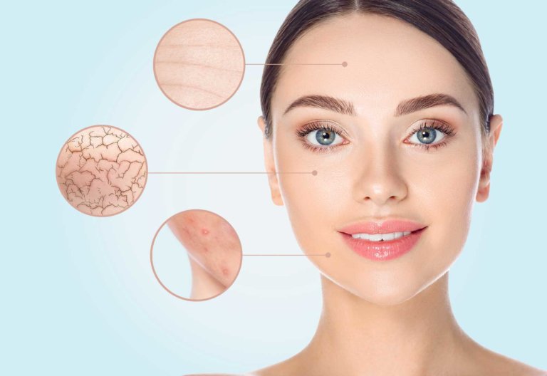 Piel deshidratada: síntomas y cómo saberlo | hedonai